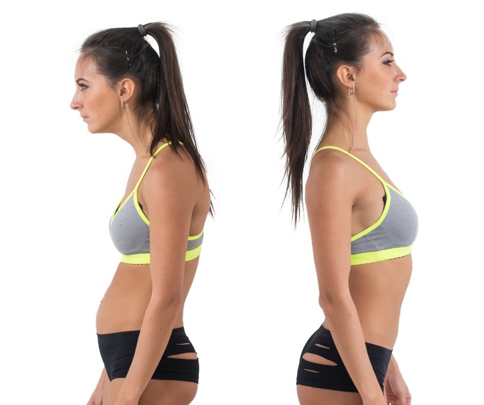 Can Chiropractors Fix Posture? Explore the Possibilites - MyChiro ... Can Chiropractors Fix Posture? Explore the Possibilites - MyChiro ...